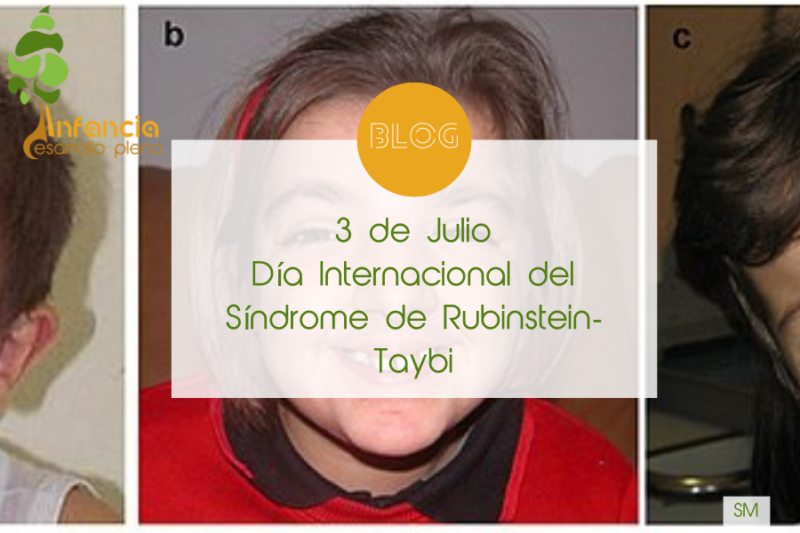 Síndrome de Rubinstein-Taybi - Infancia y Desarrollo Pleno